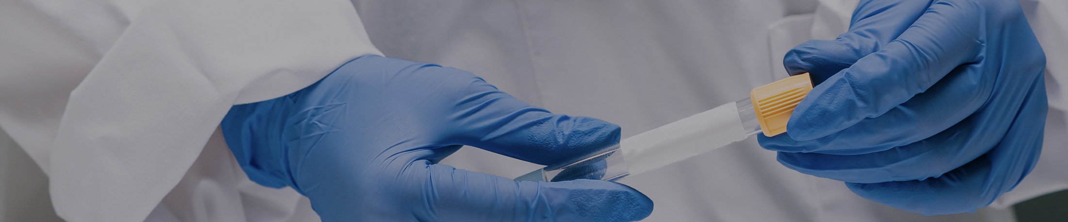 STD Screening and Prevention - Golden Gate Obstetrics & Gynecology